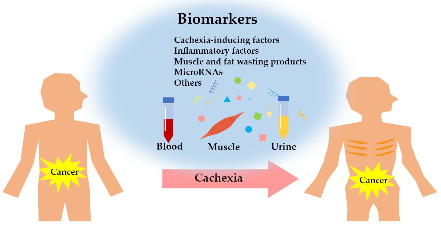 IJMS | Free Full-Text | Biomarkers for Cancer Cachexia: A Mini Review