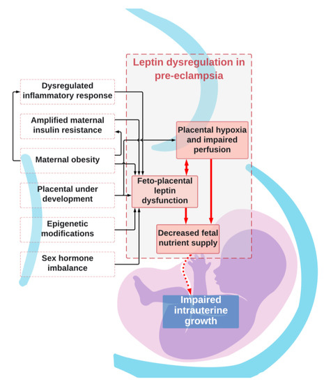 The Role of Leptin in Fetal Growth during Pre-Eclampsia