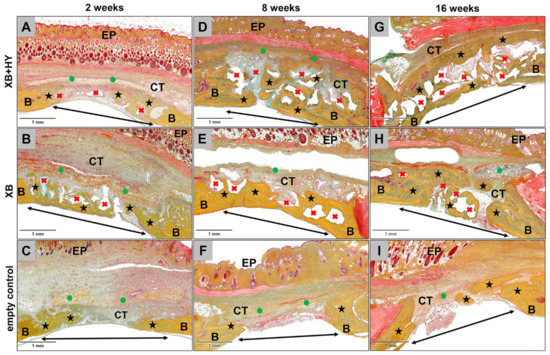 In Vivo Analysis of the Biocompatibility and Bone Healing Capacity of a ...