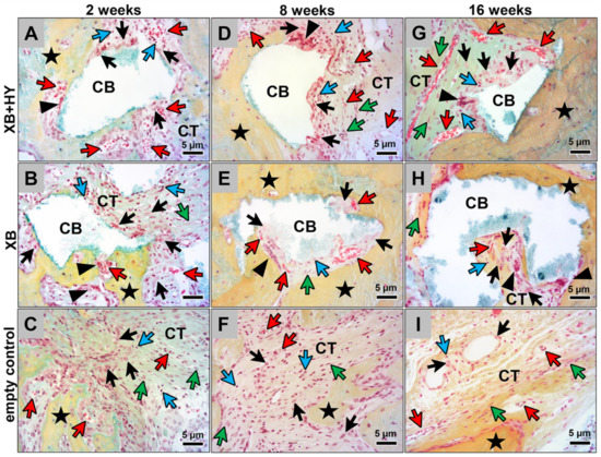 In Vivo Analysis of the Biocompatibility and Bone Healing Capacity of a ...