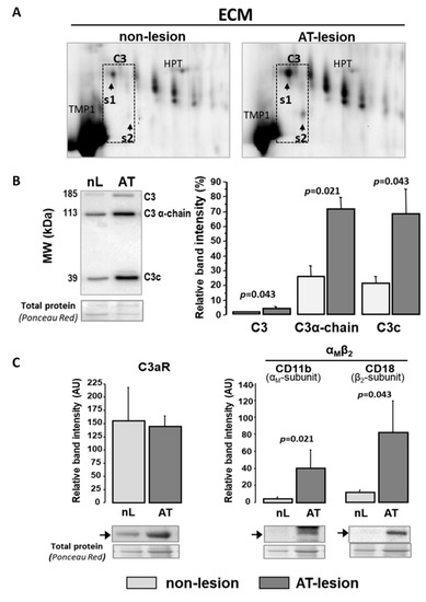 Alternative C3 Complement System: Lipids and Atherosclerosis