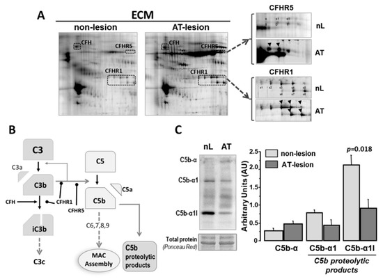 Alternative C3 Complement System: Lipids and Atherosclerosis