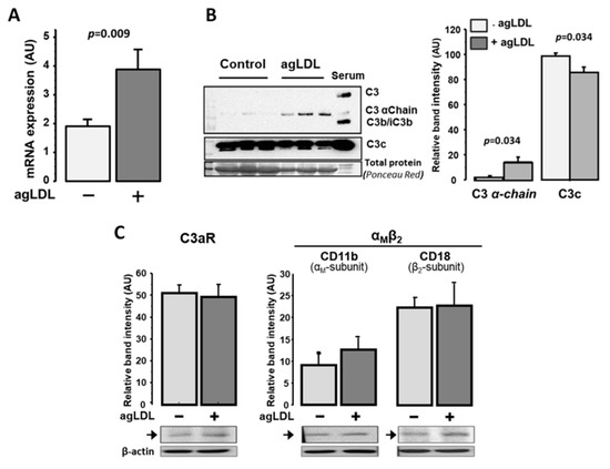 Alternative C3 Complement System: Lipids and Atherosclerosis