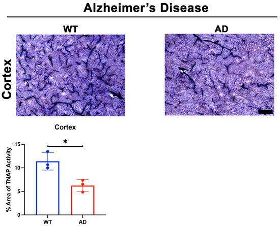 IJMS | Free Full-Text | Tissue-Nonspecific Alkaline Phosphatase in ...