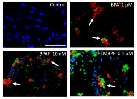 BPA, BPAF and TMBPF Alter Adipogenesis and Fat Accumulation in Human ...