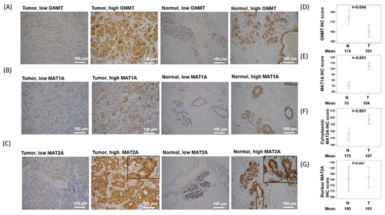 MAT2A Localization and Its Independently Prognostic Relevance in Breast ...