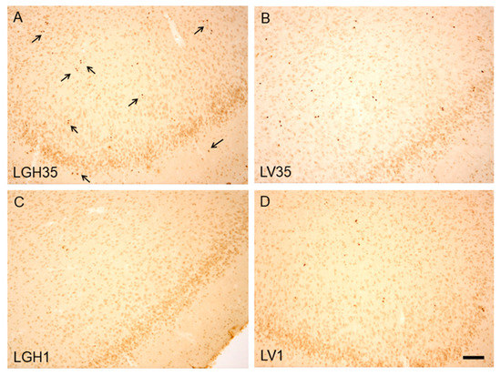 Cell Proliferation in the Piriform Cortex of Rats with Motor Cortex ...