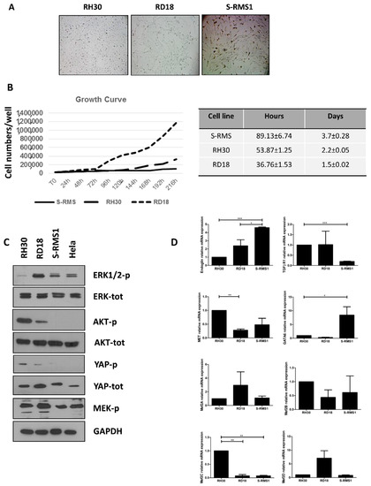 Establishment and Characterization of a Cell Line (S-RMS1) Derived from ...