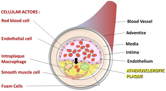 Erythrocytes: Central Actors in Multiple Scenes of Atherosclerosis