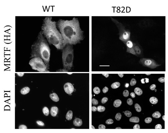 MRTF: Basic Biology and Role in Kidney Disease