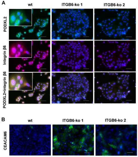 ITGB6-Knockout Suppresses Cholangiocarcinoma Cell Migration and ...