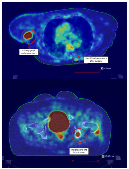 Merkel Cell Carcinoma from Molecular Pathology to Novel Therapies