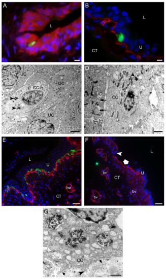 How Cancer Cells Invade Bladder Epithelium and Form Tumors: The Mouse ...