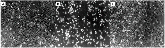 Novel Techniques to Improve Precise Cell Injection