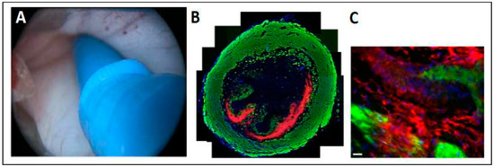Novel Techniques to Improve Precise Cell Injection