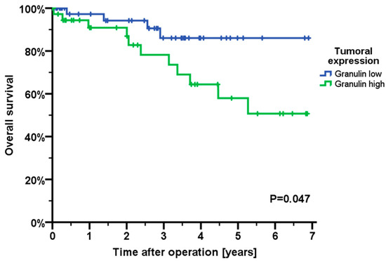 Granulin: An Invasive and Survival-Determining Marker in Colorectal ...