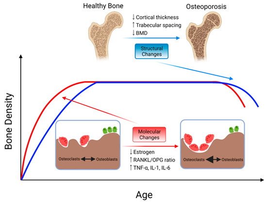 18F-Sodium Fluoride PET as a Diagnostic Modality for Metabolic ...