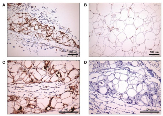 IJMS | Free Full-Text | Complement Factor D (adipsin) Levels Are ...