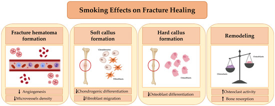 Skeletal System Biology and Smoke Damage: From Basic Science to Medical ...