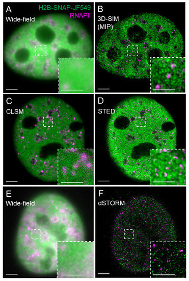 How Single-Molecule Localization Microscopy Expanded Our Mechanistic ...
