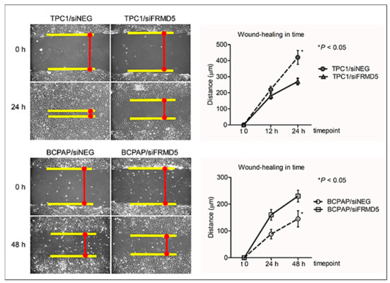 Analysis of the Role of FRMD5 in the Biology of Papillary Thyroid Carcinoma