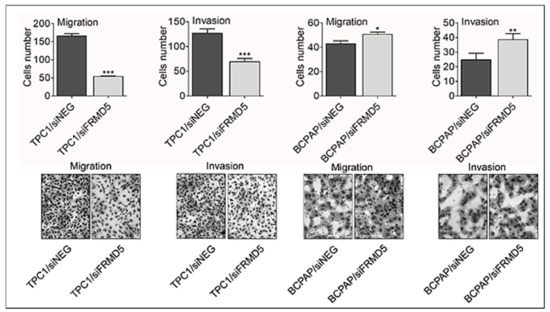 Analysis of the Role of FRMD5 in the Biology of Papillary Thyroid Carcinoma