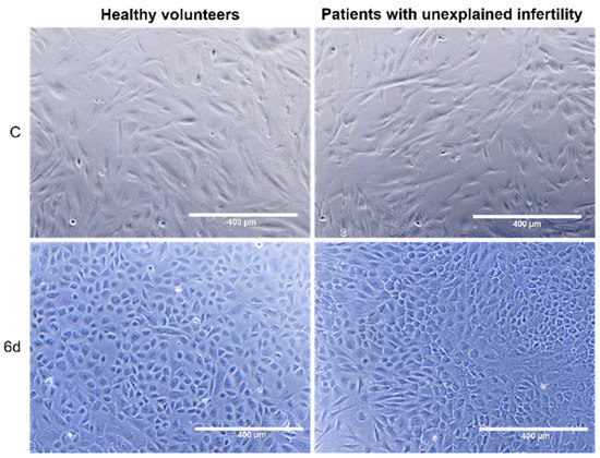 Menstrual Blood-Derived Endometrial Stem Cells’ Impact for the ...
