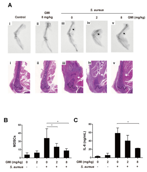 GMI, an Immunomodulatory Peptide from Ganoderma microsporum, Restrains ...
