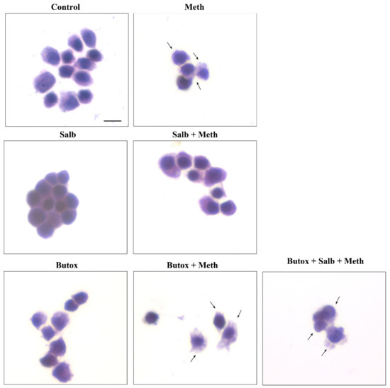 Norepinephrine Protects against Methamphetamine Toxicity through β2 ...