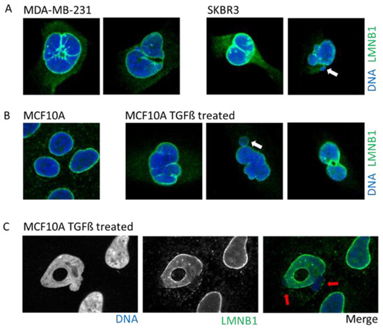 Nuclear Envelope Integrity in Health and Disease: Consequences on ...