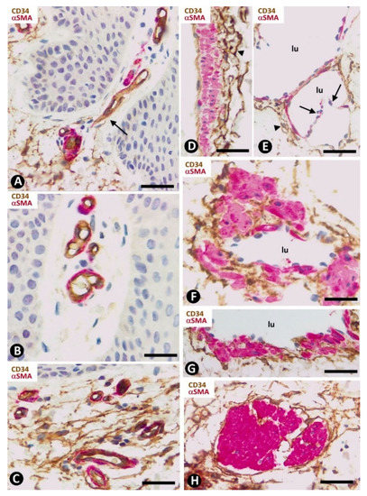 IJMS | Free Full-Text | Cd34+ Stromal Cells/Telocytes in Normal and ...