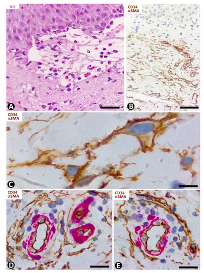 IJMS | Free Full-Text | Cd34+ Stromal Cells/Telocytes in Normal and ...