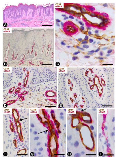 IJMS | Free Full-Text | Cd34+ Stromal Cells/Telocytes in Normal and ...