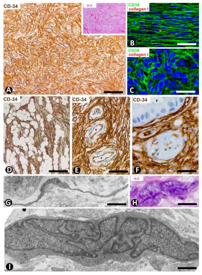IJMS | Free Full-Text | Cd34+ Stromal Cells/Telocytes in Normal and ...