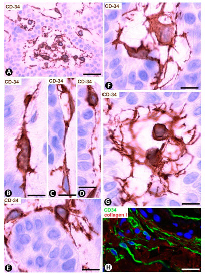 IJMS | Free Full-Text | Cd34+ Stromal Cells/Telocytes in Normal and ...