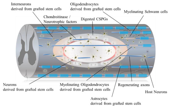 Current Concepts of Stem Cell Therapy for Chronic Spinal Cord Injury