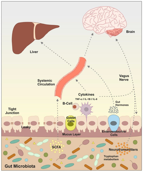 The Immune System through the Lens of Alcohol Intake and Gut Microbiota