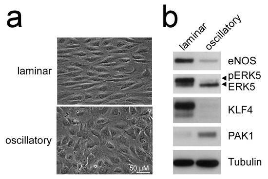 The MEK5/ERK5 Pathway in Health and Disease