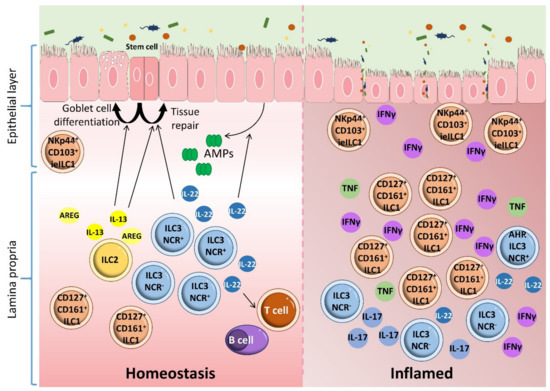 IJMS | Free Full-Text | Innate Lymphoid Cells in Intestinal Homeostasis ...