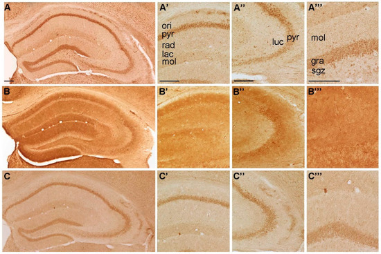 Analysis of Spatial and Temporal Distribution of Purinergic P2 ...