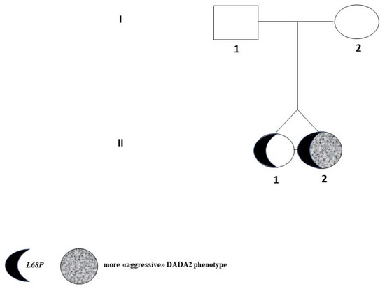 IJMS | Free Full-Text | A Novel Germline Mutation of ADA2 Gene in Two ...