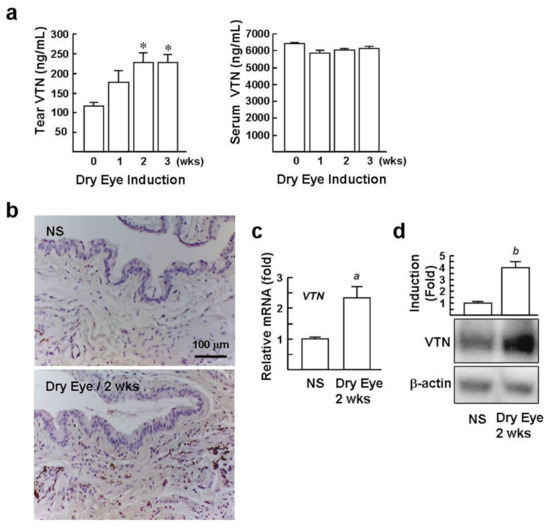 Integrin αv and Vitronectin Prime Macrophage-Related Inflammation and ...