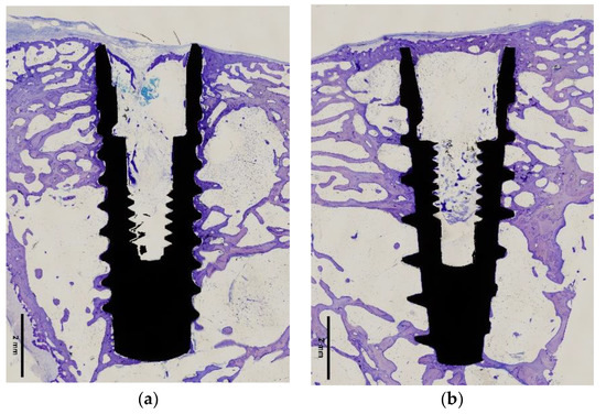 Osseointegration of Sandblasted and Acid-Etched Implant Surfaces. A ...
