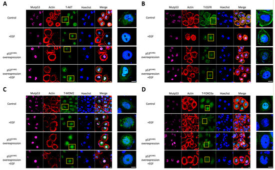 Gain-of-Function Mutant TP53 R248Q Overexpressed in Epithelial Ovarian ...