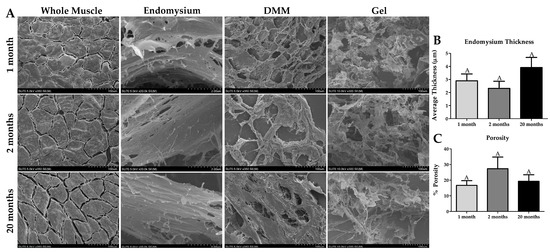 Advanced Glycation End Products Are Retained in Decellularized Muscle ...