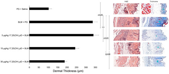 17,20S(OH)2pD Can Prevent the Development of Skin Fibrosis in the ...