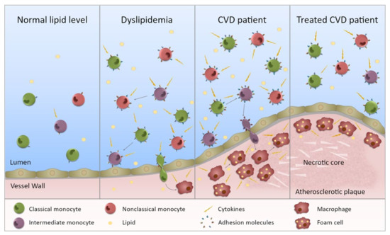 Nature versus Number: Monocytes in Cardiovascular Disease