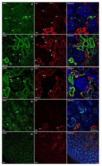 IJMS | Free Full-Text | CRKL, AIFM3, AIF, BCL2, and UBASH3A during ...