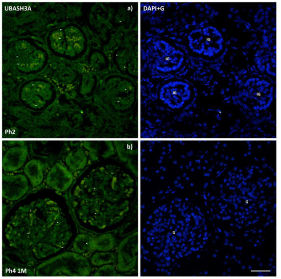 CRKL, AIFM3, AIF, BCL2, and UBASH3A during Human Kidney Development