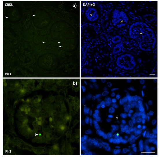 CRKL, AIFM3, AIF, BCL2, and UBASH3A during Human Kidney Development